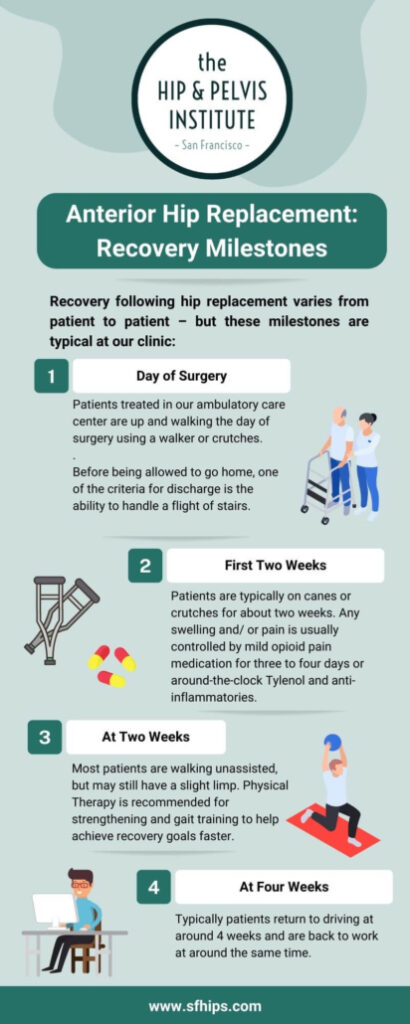 Anterior Hip Replacement Recovery Milestones - Dr. Mast